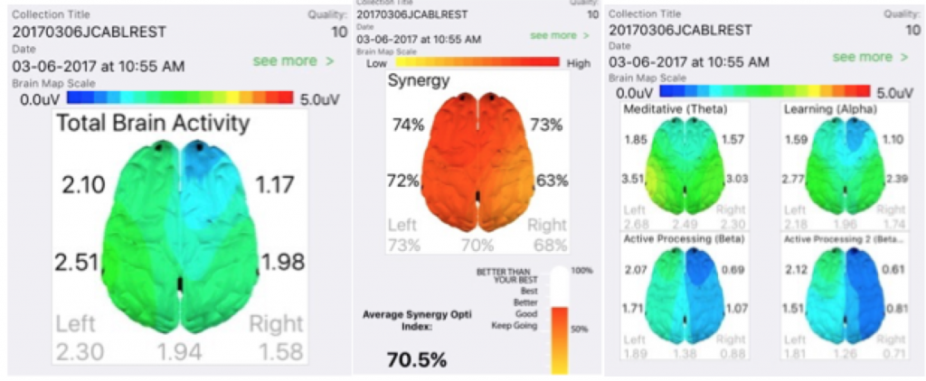 Enhancing Practice with OPTI Brain - Opti Brain
