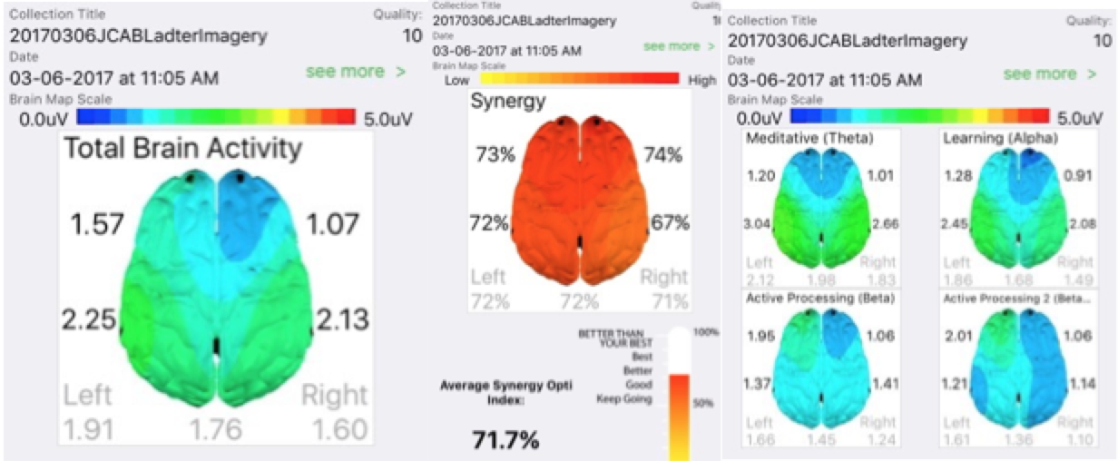 Enhancing Practice with OPTI Brain - Opti Brain