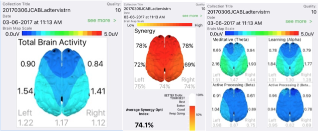 Enhancing Practice with OPTI Brain - Opti Brain