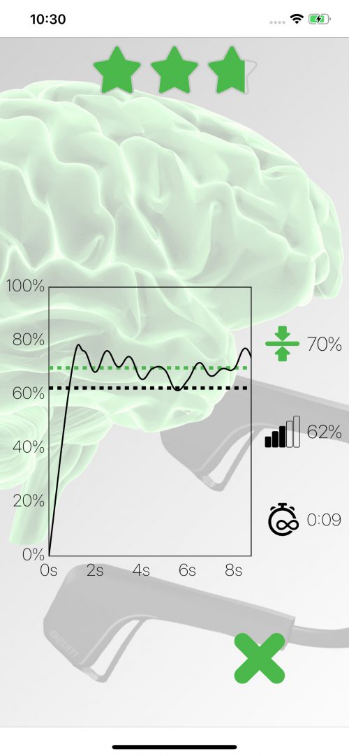 Understanding the Opti Index - Opti Brain