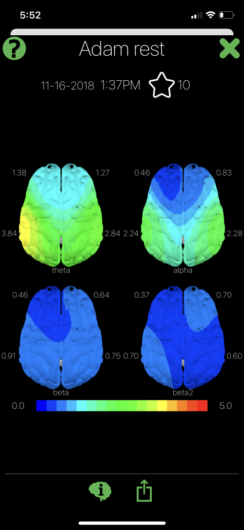Opti Train, Calm and Confidence Maps - Opti Brain