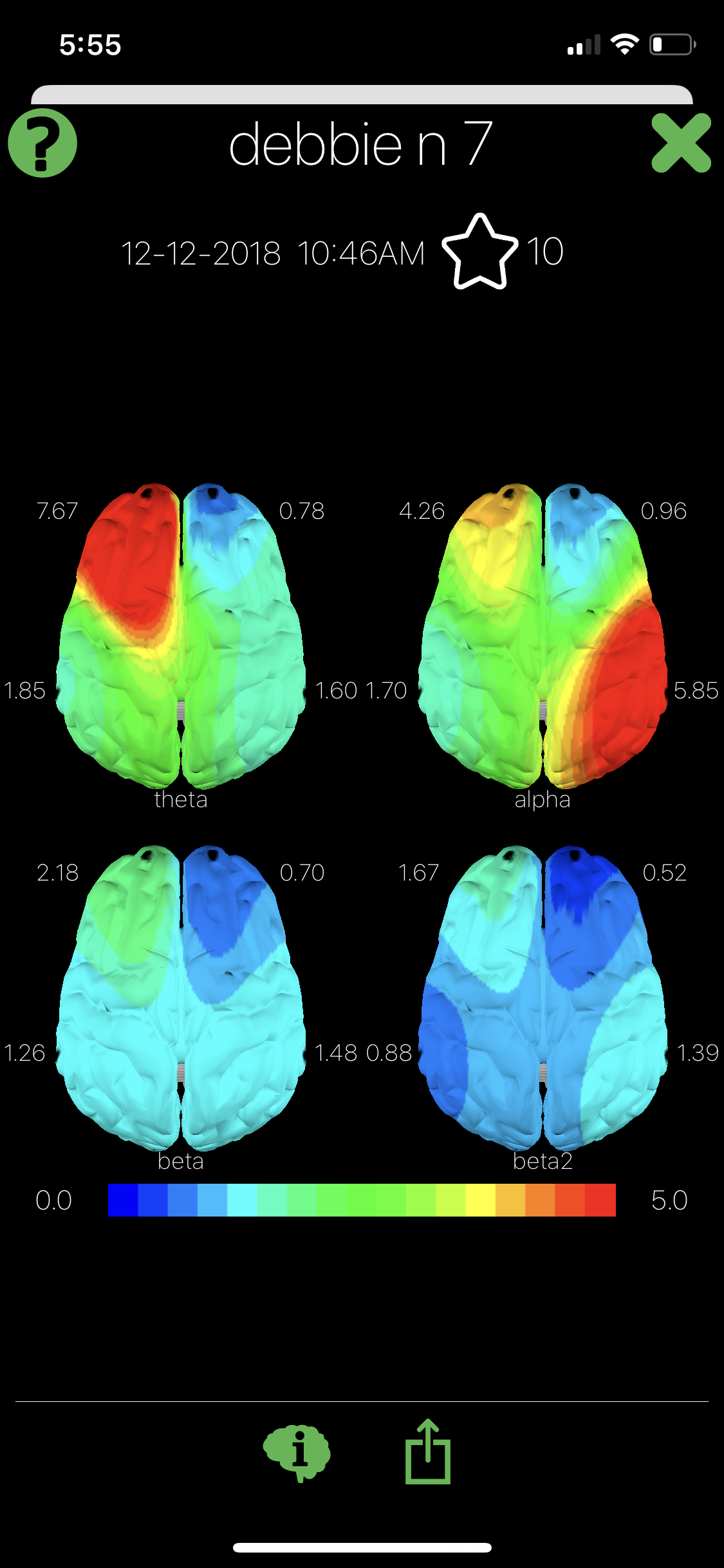 Opti Train, Calm and Confidence Maps - Opti Brain