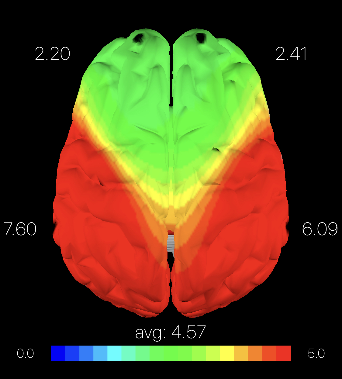 Total Brain Activity - Opti Brain