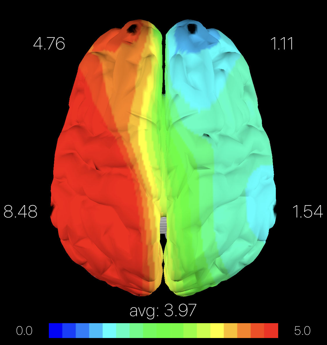Total Brain Activity - Opti Brain