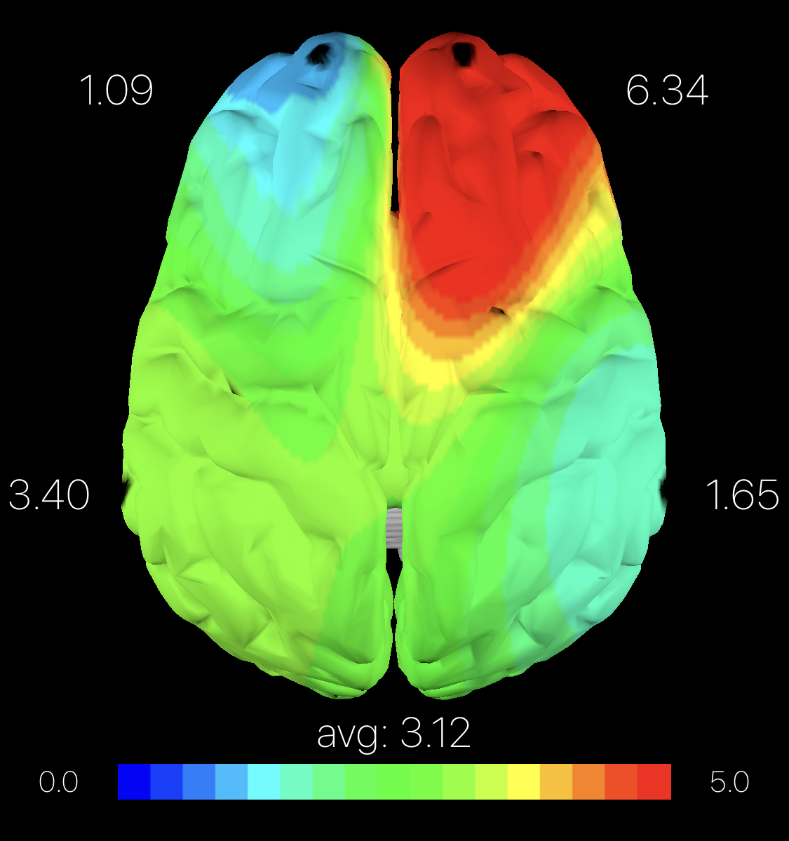 Total Brain Activity - Opti Brain