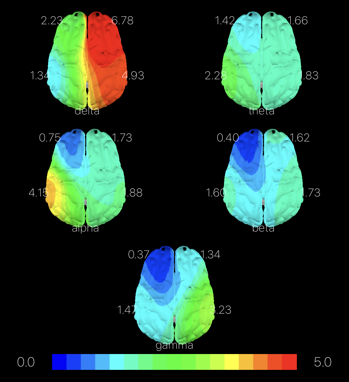 Levels of Thought (Power Bands) - Opti Brain