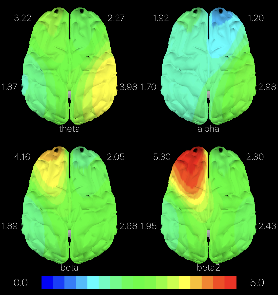 Levels of Thought (Power Bands) - Opti Brain